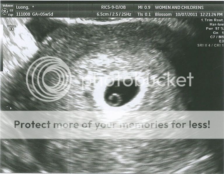 AL and JOJO, Please have a look at my 5w5d ultrasound! in Gender ...