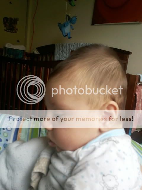 Pointy Head? - BabyCenter